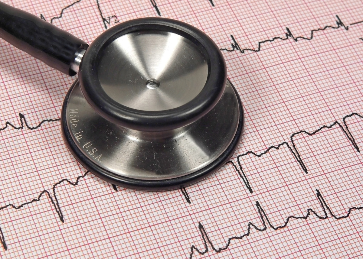 Understanding Cardiac Imaging: Calcium CT, Coronary Angiograms, and ...